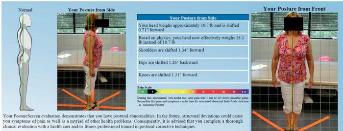 How bad posture effects your health as we age